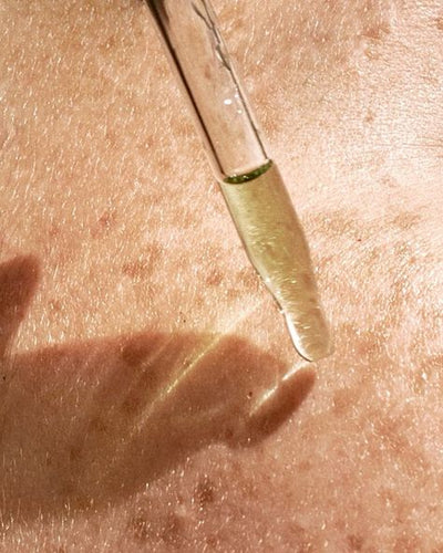 UNDERSTANDING MELASMA: A CHRONIC CONDITION THAT REQUIRES A COMPREHENSI ...