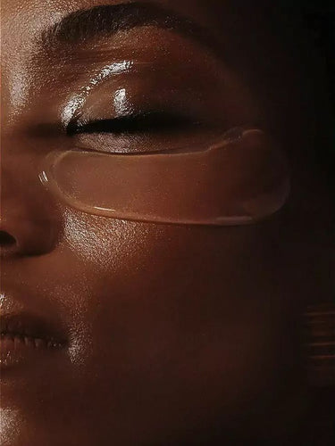 THE INTRICACIES OF UNDER EYES: WHAT ACTUALLY WORKS? – amare aesthetics
