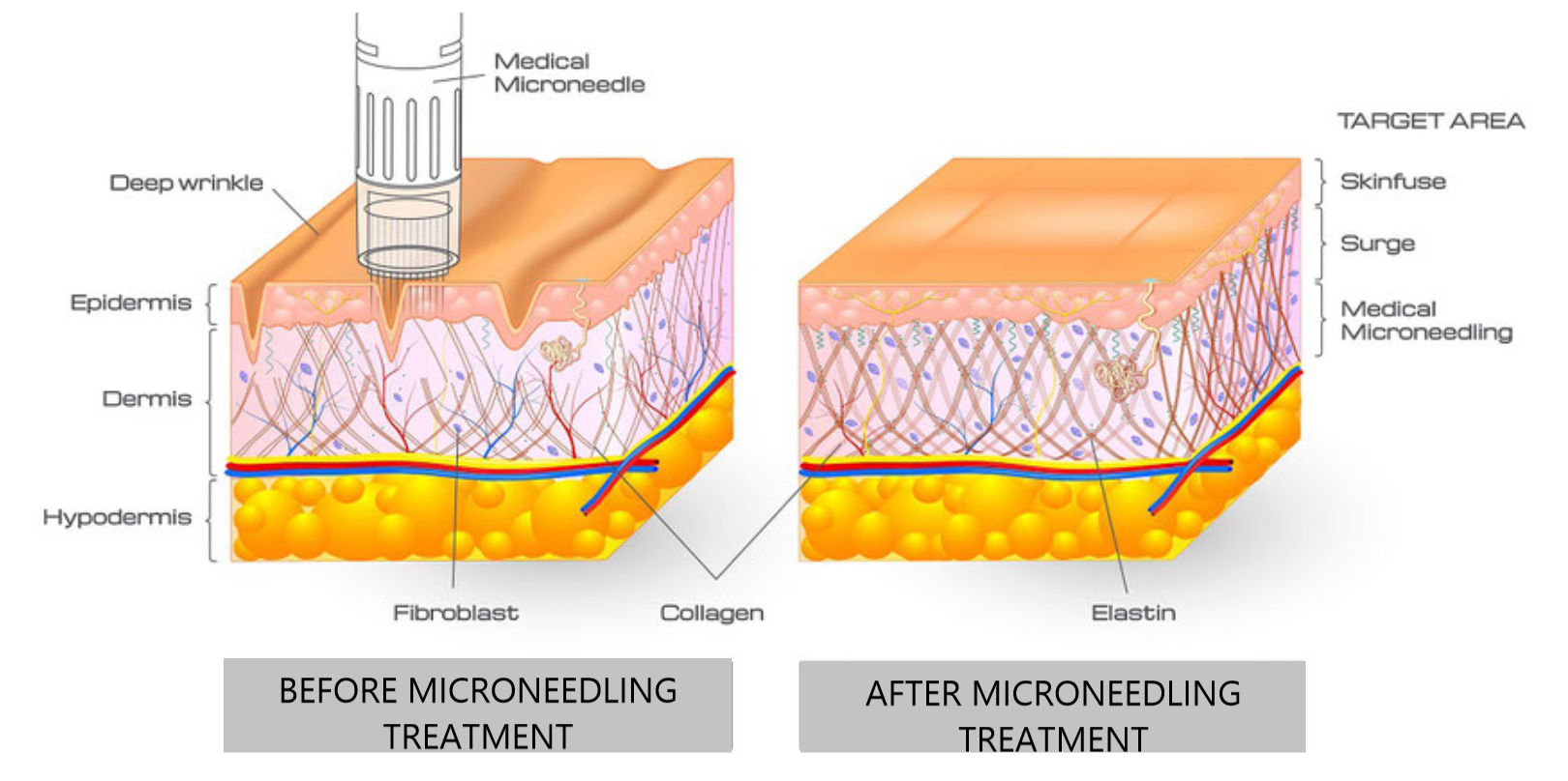 SKINPEN – amare aesthetics